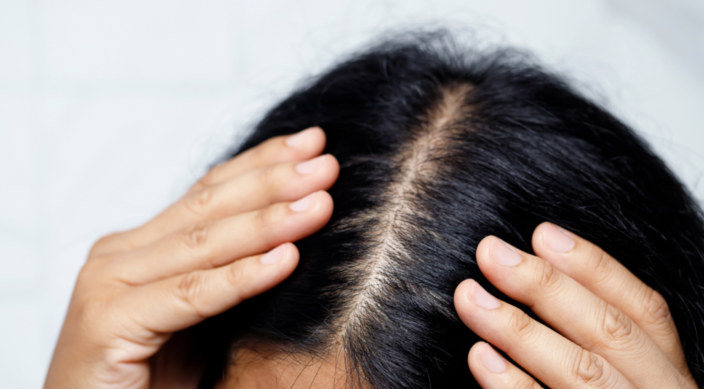 Scalp microbiome: What is its role and importance? — Hairborist Pro